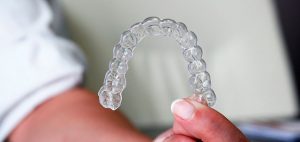 Invisalign. La ortodoncia invisible – Estudi Dental Barcelona