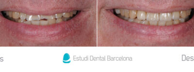 Clínica Dental Barcelona [Odontología] - Estudi Dental