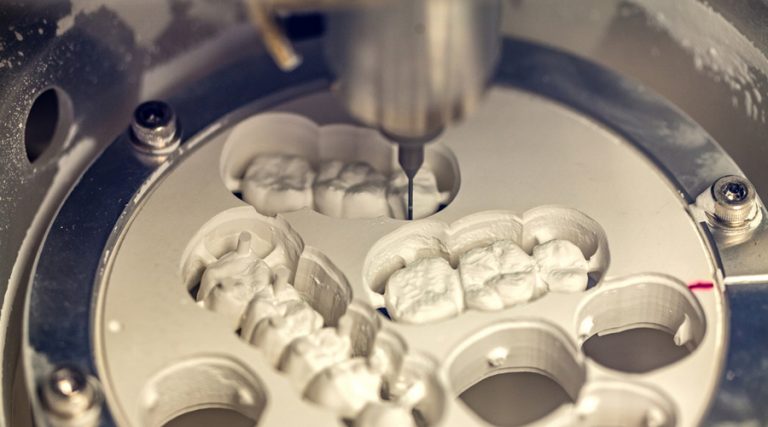 ¿En qué consiste el tallado dental para carillas de porcelana? – Estudi ...