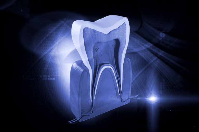 ¿Qué es una pulpotomía y cuándo es necesaria? – Estudi Dental Barcelona