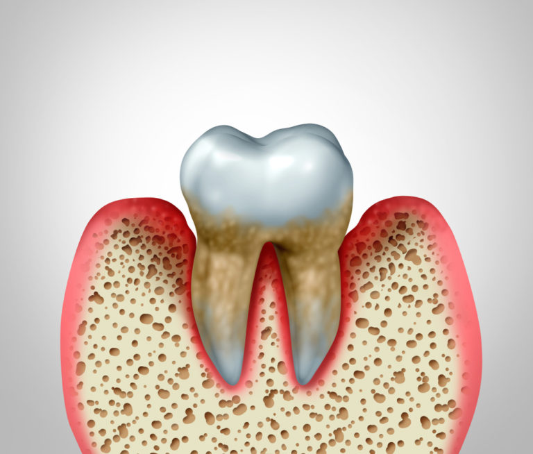 Periodoncia – Estudi Dental Barcelona