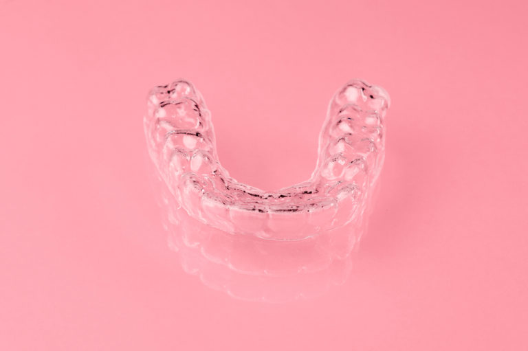 Retenedores de dientes – Estudi Dental Barcelona